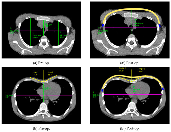 Computer-Aided Design and Manufacturing Technology for Identification ...