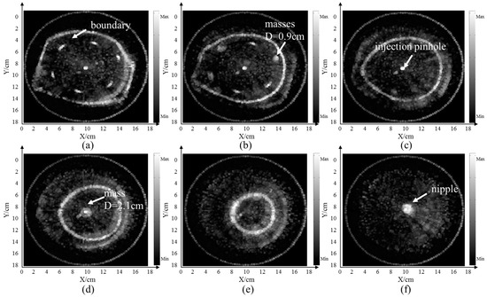 Applied Sciences | Special Issue : Ultrasound B-mode Imaging ...