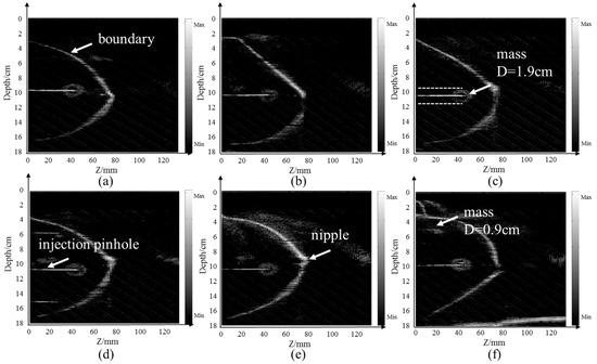 Applied Sciences | Special Issue : Ultrasound B-mode Imaging ...