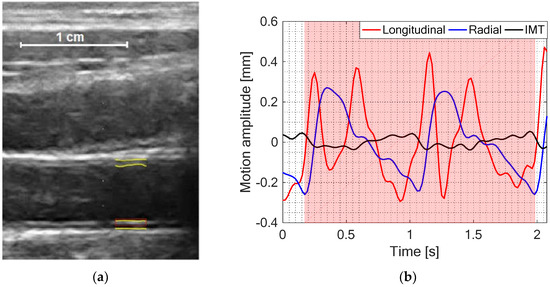 Applied Sciences | Special Issue : Ultrasound B-mode Imaging ...