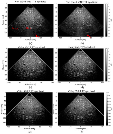 Applied Sciences | Special Issue : Ultrasound B-mode Imaging ...