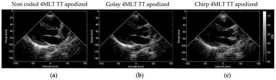 Applied Sciences | Special Issue : Ultrasound B-mode Imaging ...