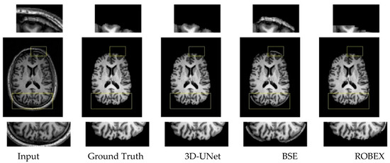 3D U-Net for Skull Stripping in Brain MRI