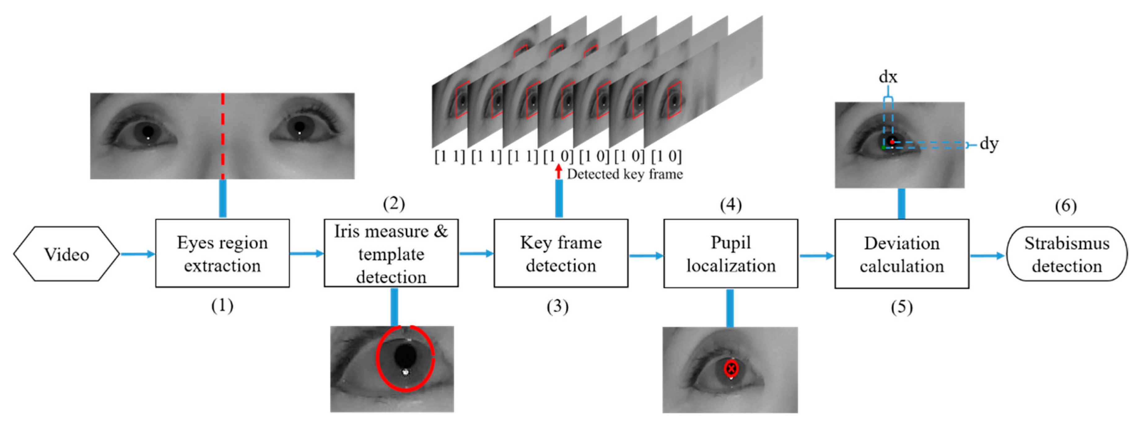 Intelligent Evaluation of Strabismus in Videos Based on an Automated ...