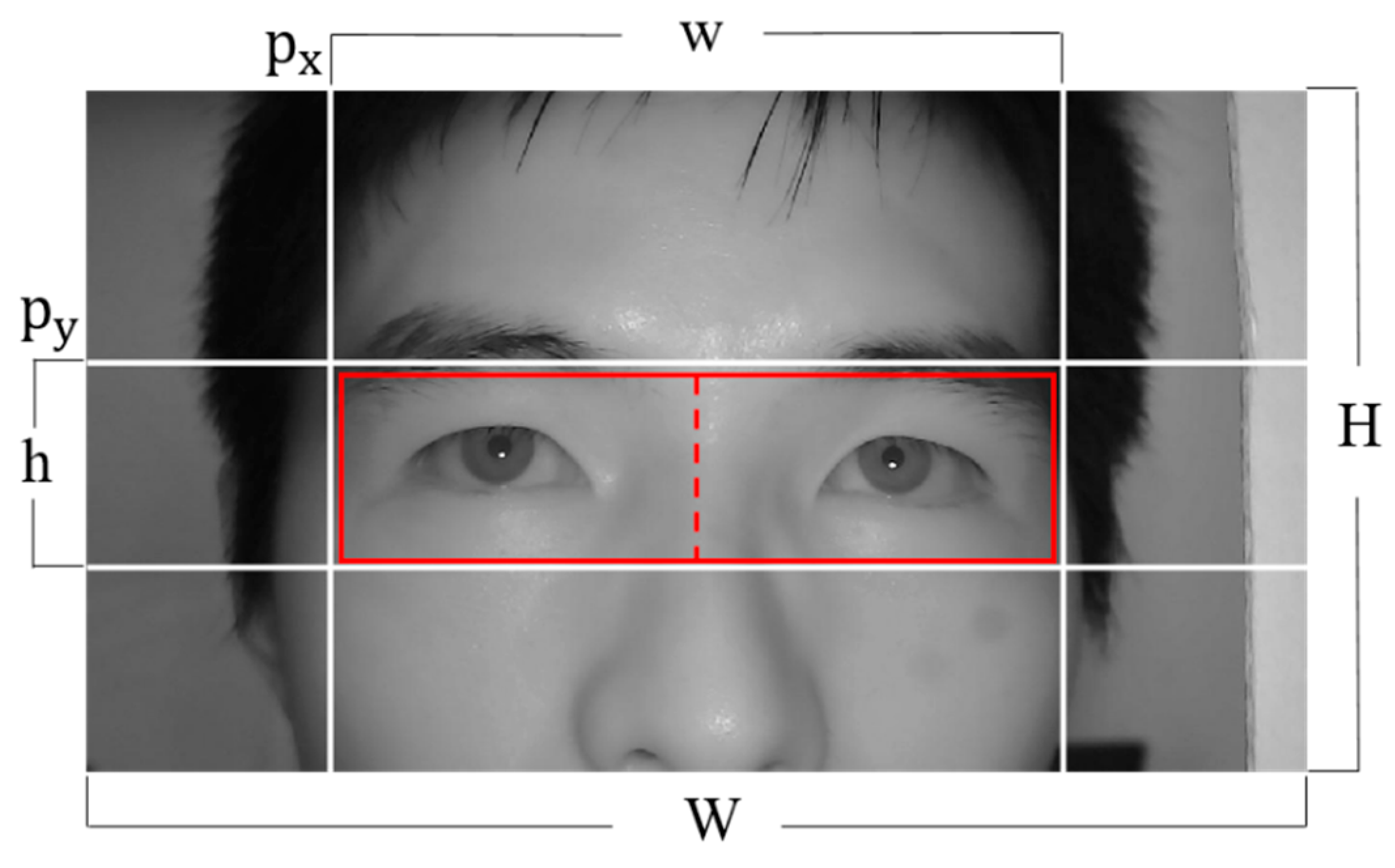 Intelligent Evaluation of Strabismus in Videos Based on an Automated ...