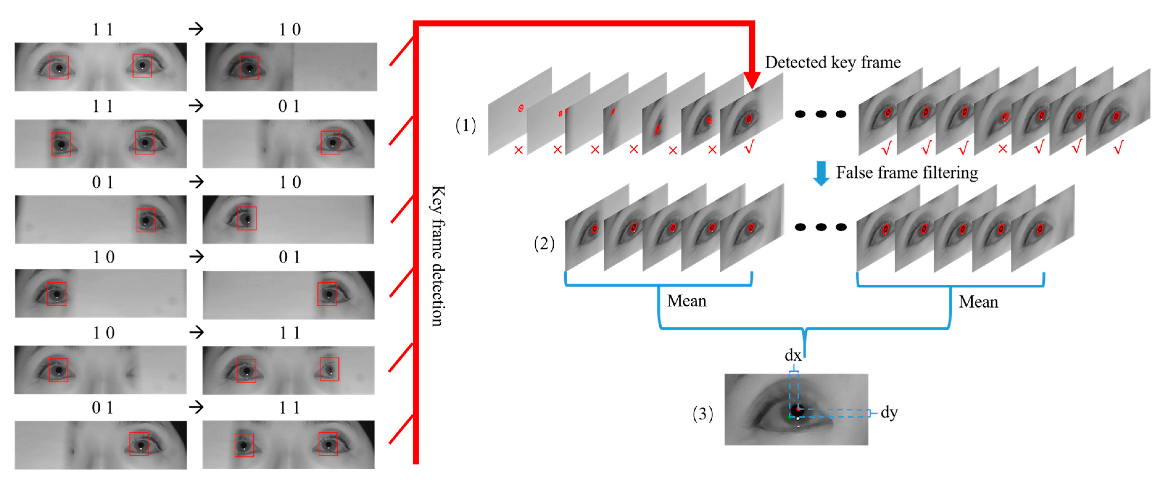 Intelligent Evaluation of Strabismus in Videos Based on an Automated ...