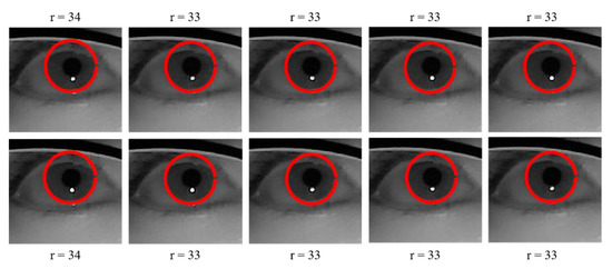 Intelligent Evaluation of Strabismus in Videos Based on an Automated ...