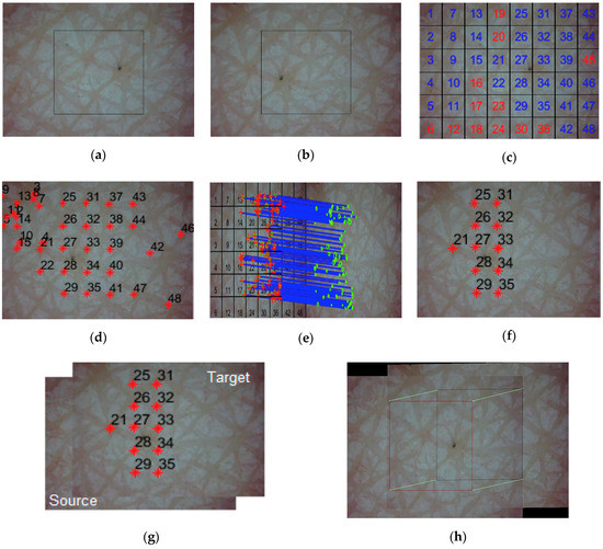 Skin Aging Estimation Scheme Based on Lifestyle and Dermoscopy Image ...
