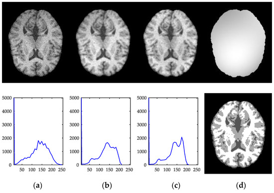 Applied Sciences | Free Full-Text | A Robust Brain MRI Segmentation and Bias Field Correction ...