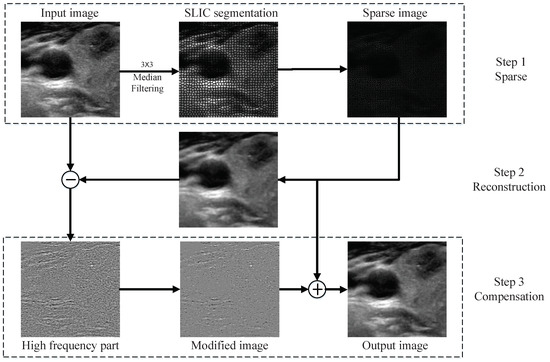 A New Ultrasound Speckle Reduction Algorithm Based on Superpixel Segmentation and Detail ...