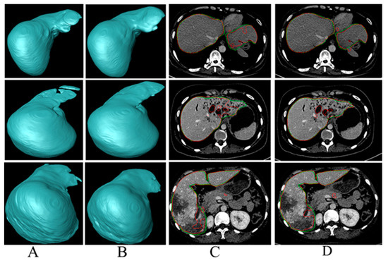 Data Balancing Based on Pre-Training Strategy for Liver Segmentation ...