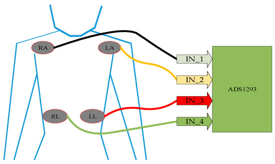 Design of a Solar-Powered Portable ECG Device with Optimal Power ...