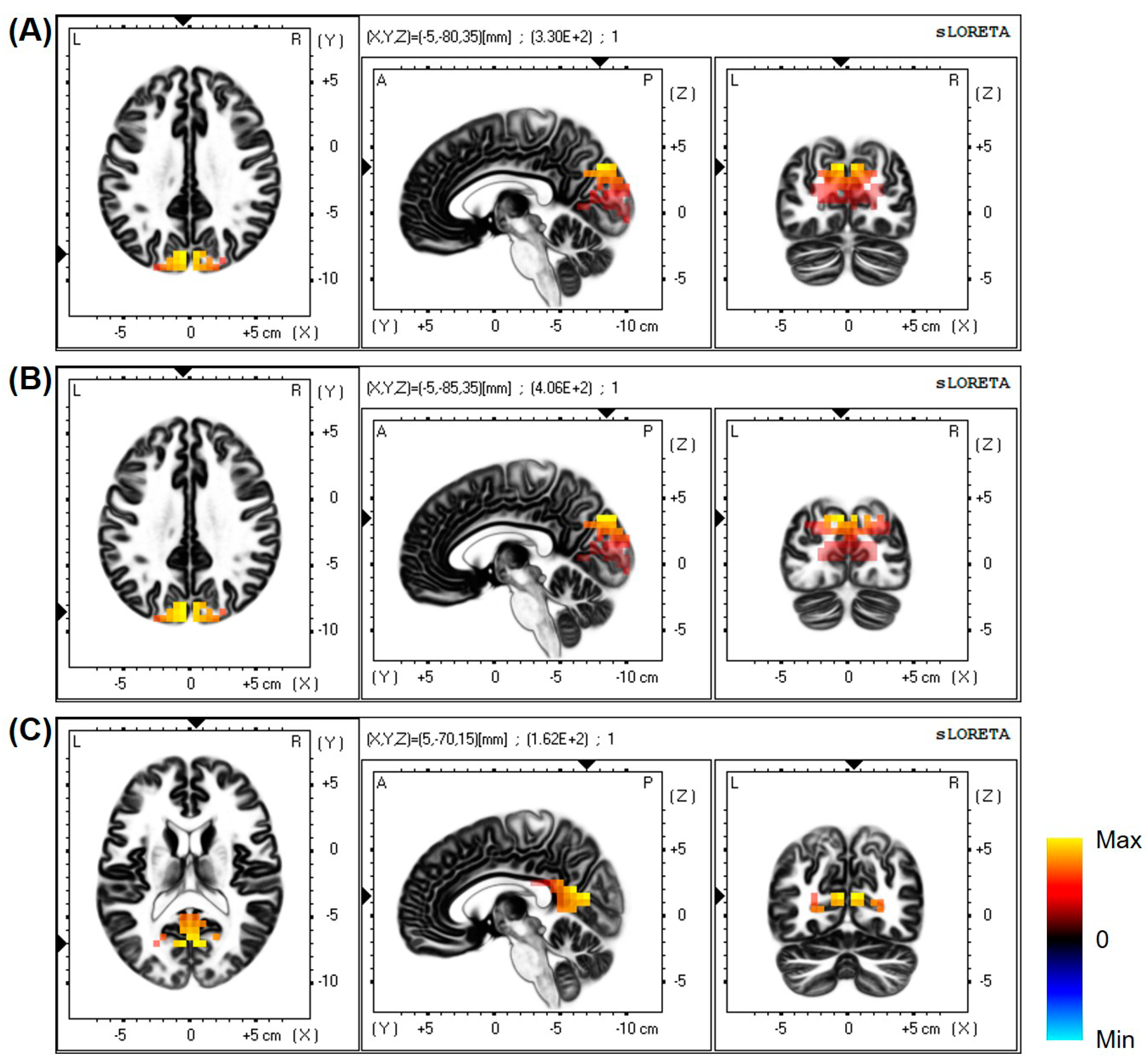 Psychophysiological Alteration After Virtual Reality Experiences Using ...