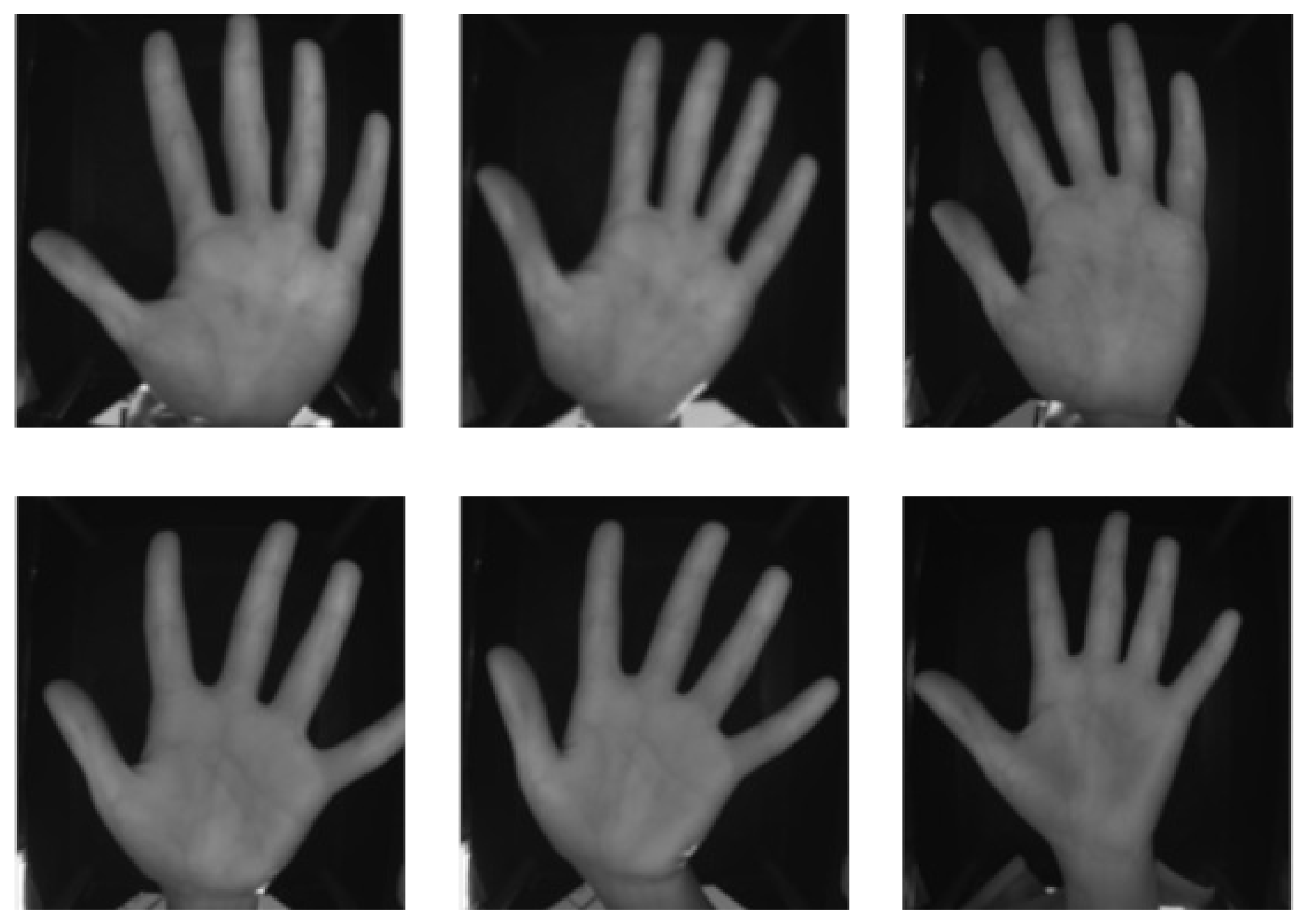 Palm Vein Technology Palm Vein Technology