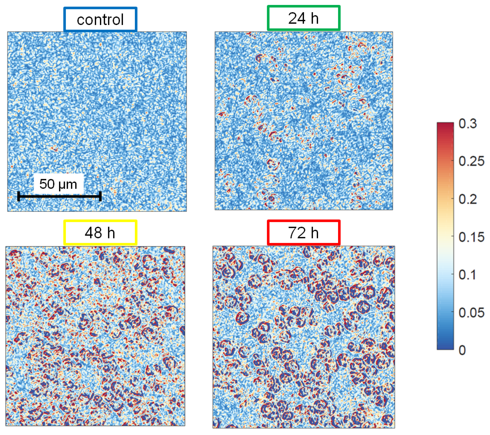Polarimetric Detection of Chemotherapy-Induced Cancer Cell Death