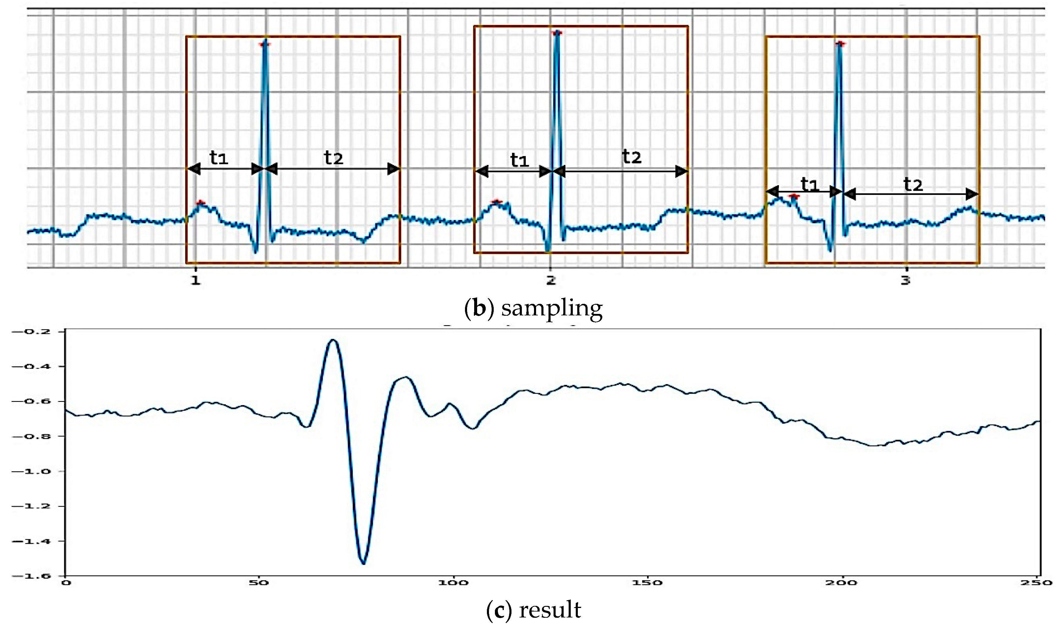 An Automated Ecg Beat Classification System Using Deep Neural Networks With An Unsupervised