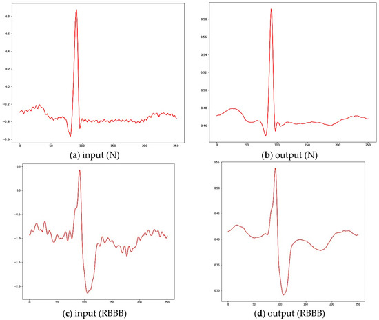 An Automated ECG Beat Classification System Using Deep Neural Networks with an Unsupervised ...