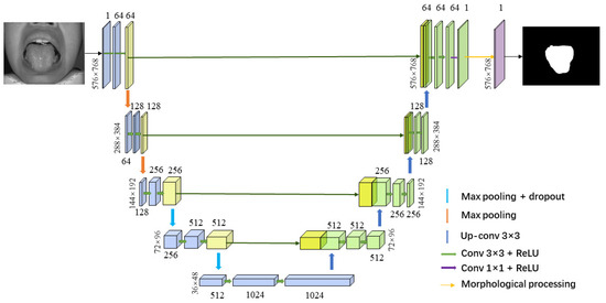 TongueNet: A Precise and Fast Tongue Segmentation System Using U-Net with a Morphological ...