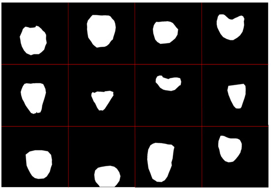 TongueNet: A Precise and Fast Tongue Segmentation System Using U-Net with a Morphological ...