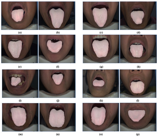 Tonguenet A Precise And Fast Tongue Segmentation System Using U Net With A Morphological