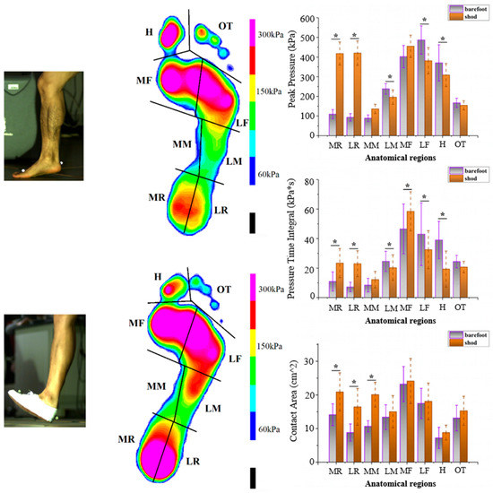 Morphology-Related Foot Function Analysis: Implications for Jumping and ...