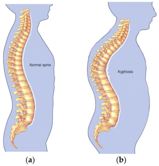 Special Issue on Using Machine Learning Algorithms in the Prediction of ...