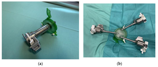 Feasibility of Transcervical Robotic-Assisted Esophagectomy (TC-RAMIE ...