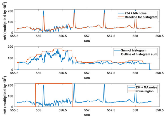 Efficient Real-Time R and QRS Detection Method Using a Pair of Derivative Filters and Max Filter ...