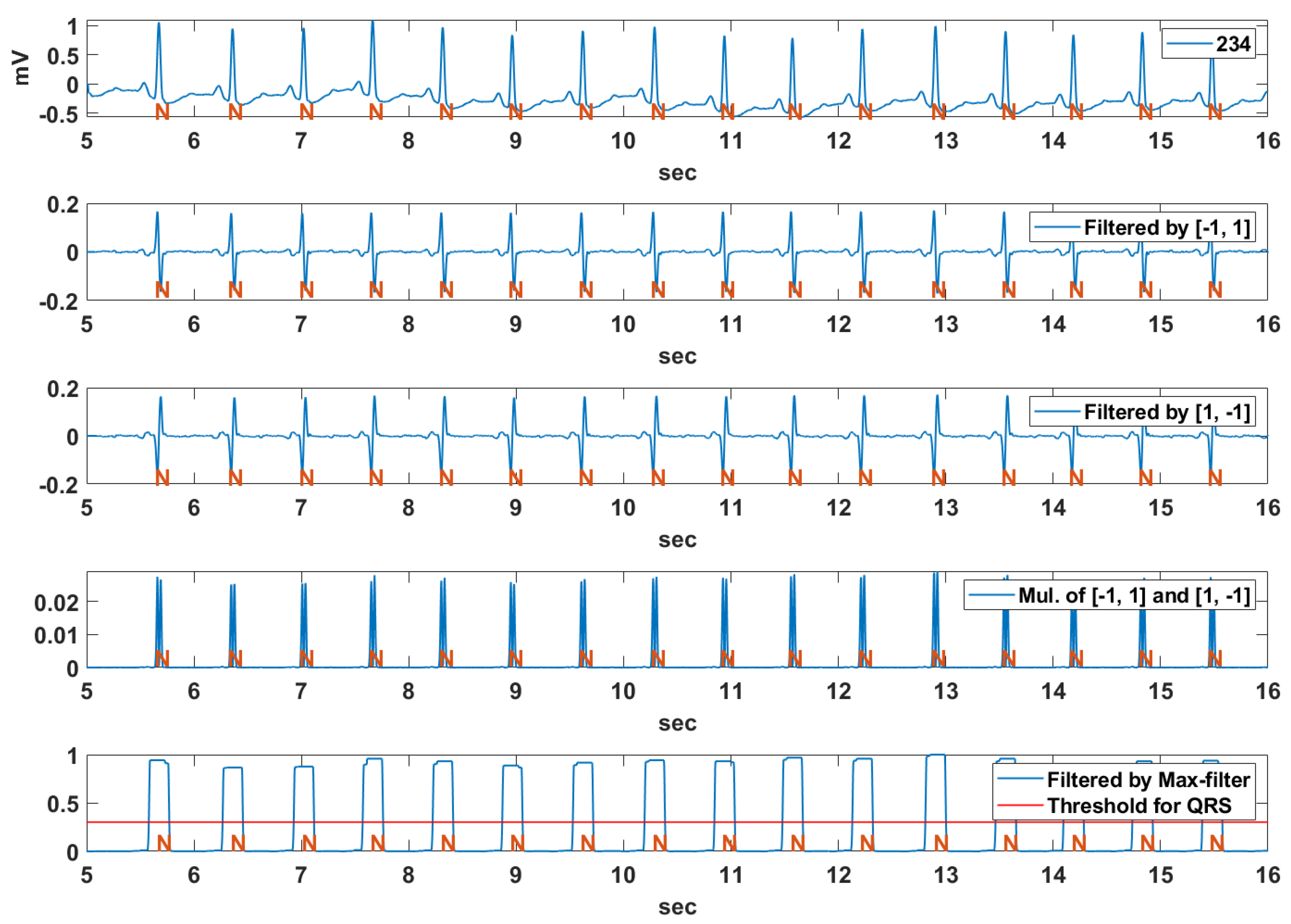 Efficient Real-Time R and QRS Detection Method Using a Pair of Derivative Filters and Max Filter ...