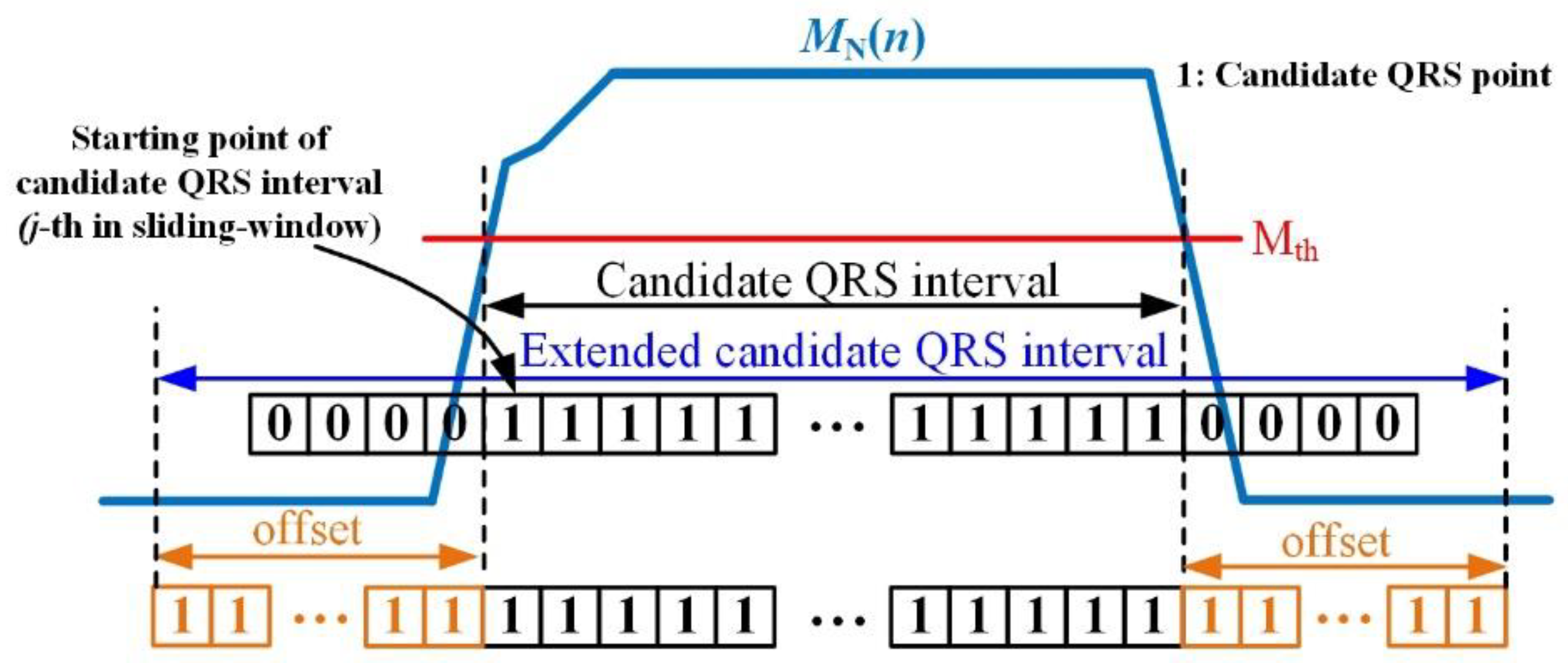 Efficient Real-Time R and QRS Detection Method Using a Pair of Derivative Filters and Max Filter ...