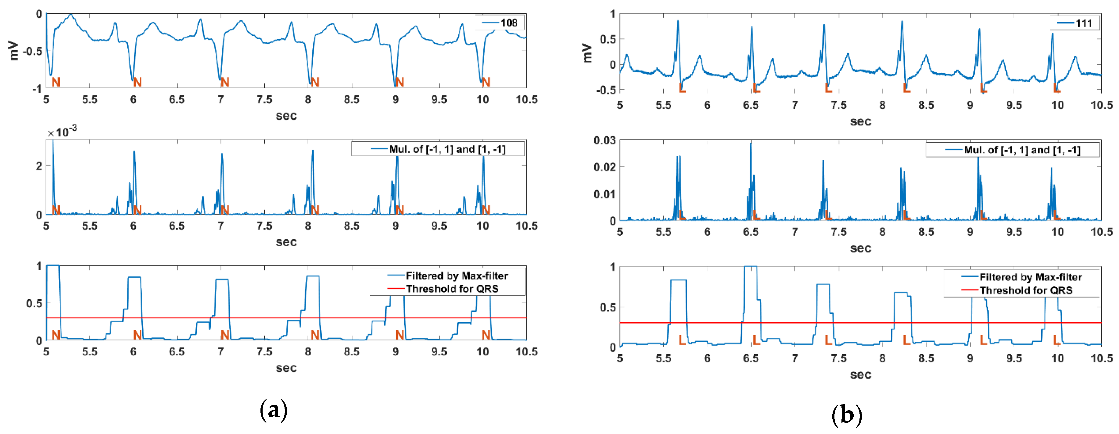 Efficient Real-Time R and QRS Detection Method Using a Pair of Derivative Filters and Max Filter ...