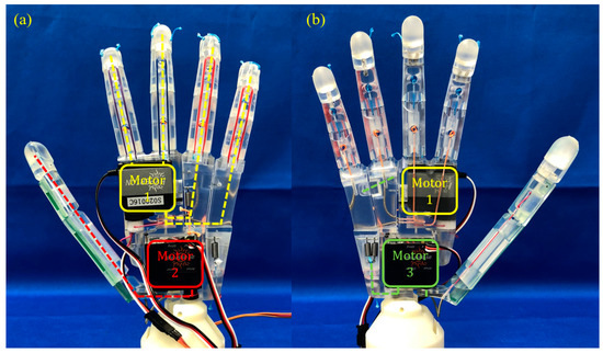 Anthropomorphic Prosthetic Hand with Combination of Light Weight and ...