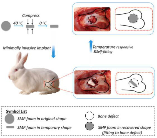 Shape Memory Polyurethane and its Composites for Various Applications