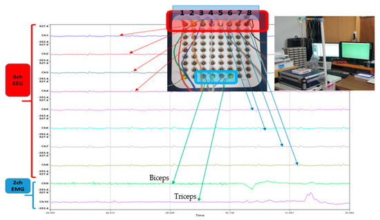 Motion Recognition and an Accuracy Comparison of Left and Right Arms by ...