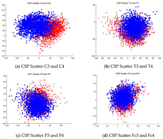 Motion Recognition and an Accuracy Comparison of Left and Right Arms by ...