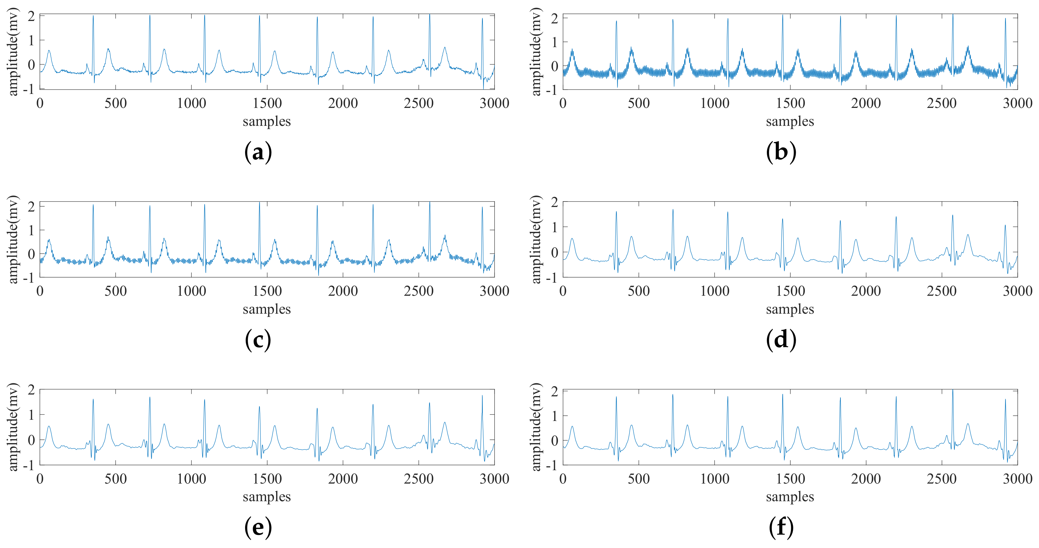 An ECG Signal De-Noising Approach Based on Wavelet Energy and Sub-Band ...