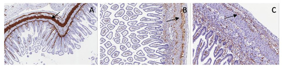 Fetal Megacystis: A New Morphologic, Immunohistological and ...