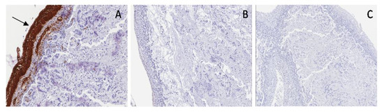 Fetal Megacystis: A New Morphologic, Immunohistological and ...