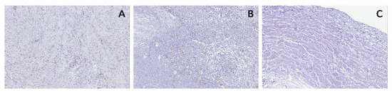 Fetal Megacystis: A New Morphologic, Immunohistological and ...