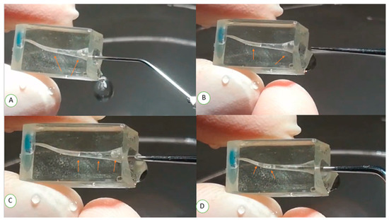 Effectiveness of Vapor Lock Effect Removal in Endo Training Blocks ...