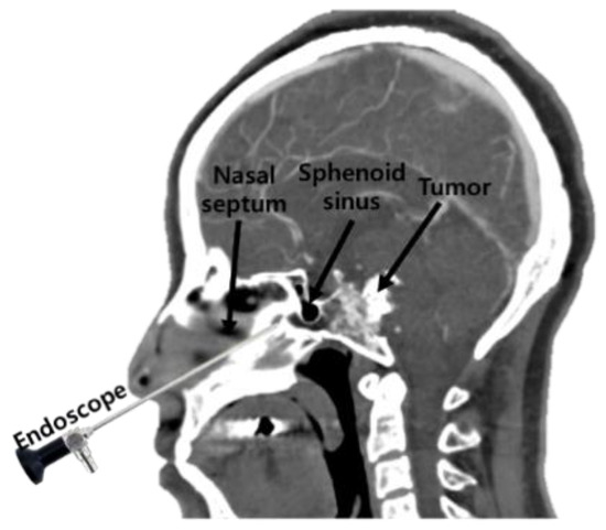 Applied Sciences | Free Full-Text | Surgical Navigation System for ...