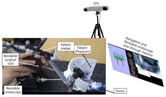 Surgical Navigation System for Transsphenoidal Pituitary Surgery ...