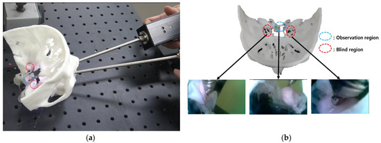 Surgical Navigation System for Transsphenoidal Pituitary Surgery ...