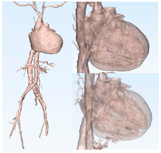 Virtual Prototyping: Computational Device Placements within Detailed ...