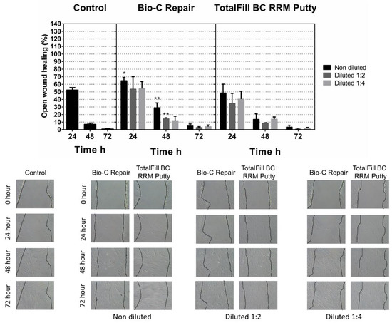 In Vitro Effect of Putty Calcium Silicate Materials on Human ...