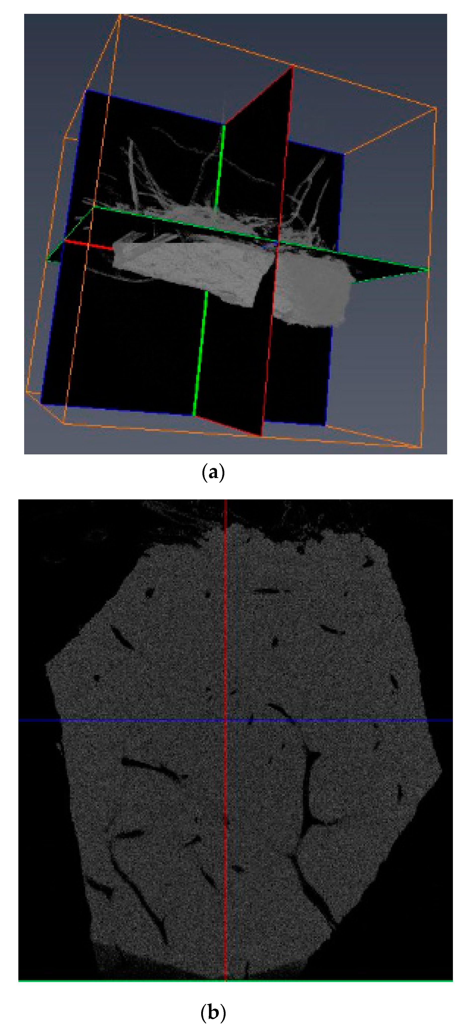 Impact Performance of a Plate Structure with Coconut-Inspired Microchannels