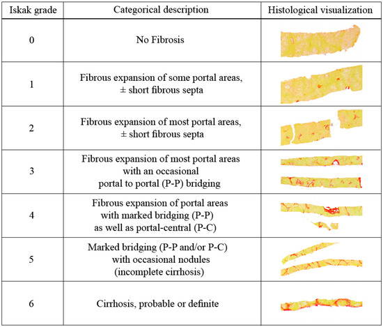 Quantification of Liver Fibrosis—A Comparative Study