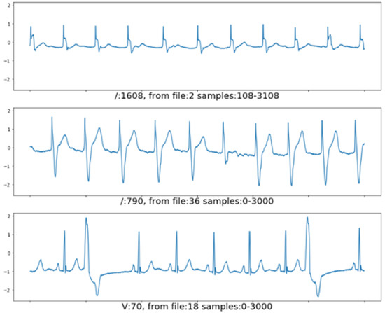 An Efficient Algorithm for Cardiac Arrhythmia Classification Using ...