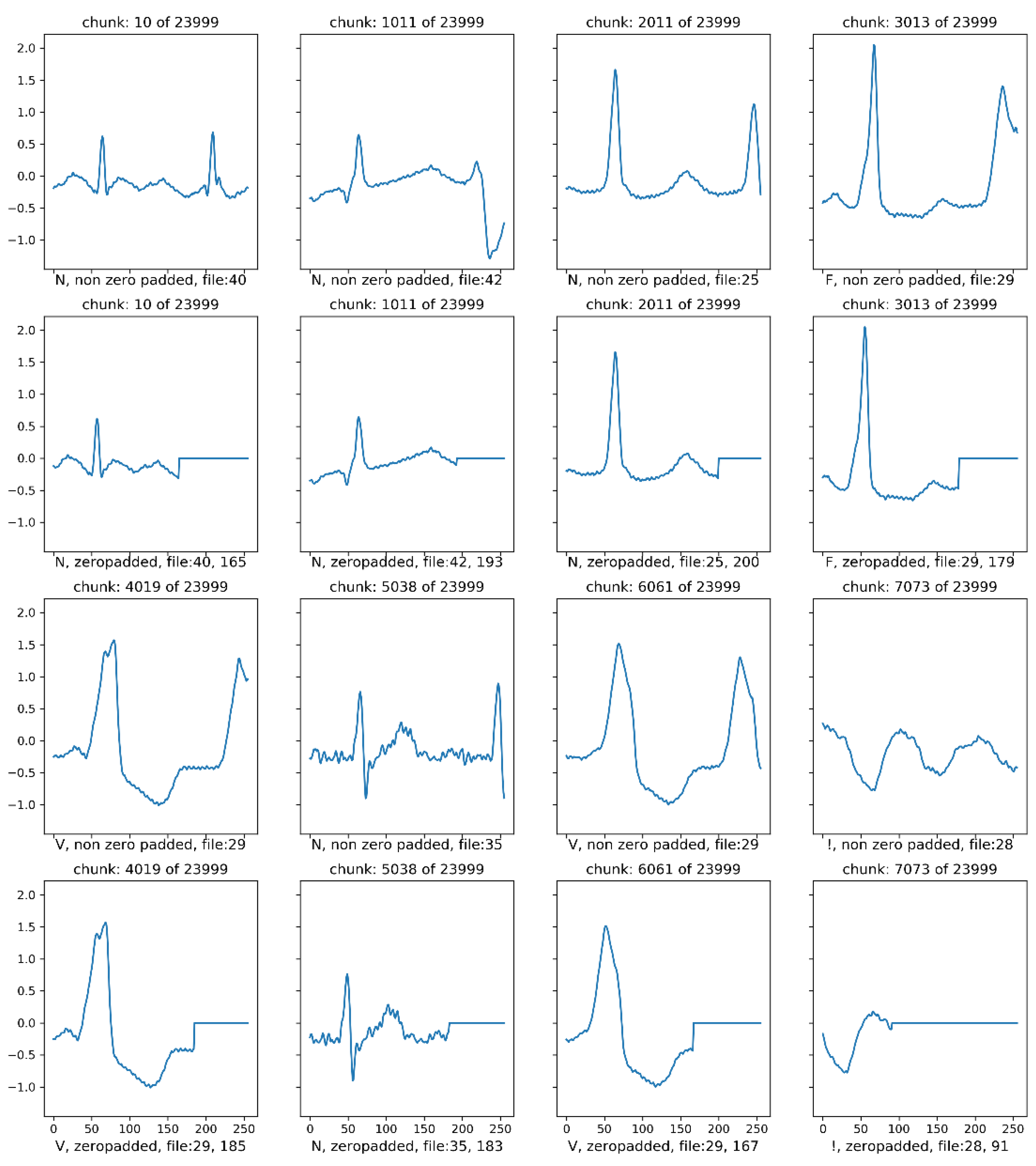 An Efficient Algorithm for Cardiac Arrhythmia Classification Using ...