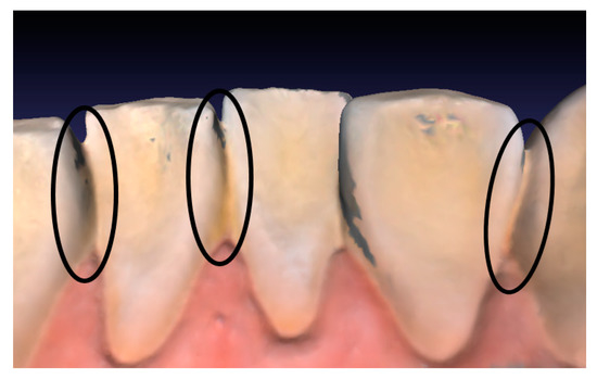 Tooth Segmentation of 3D Scan Data Using Generative Adversarial Networks